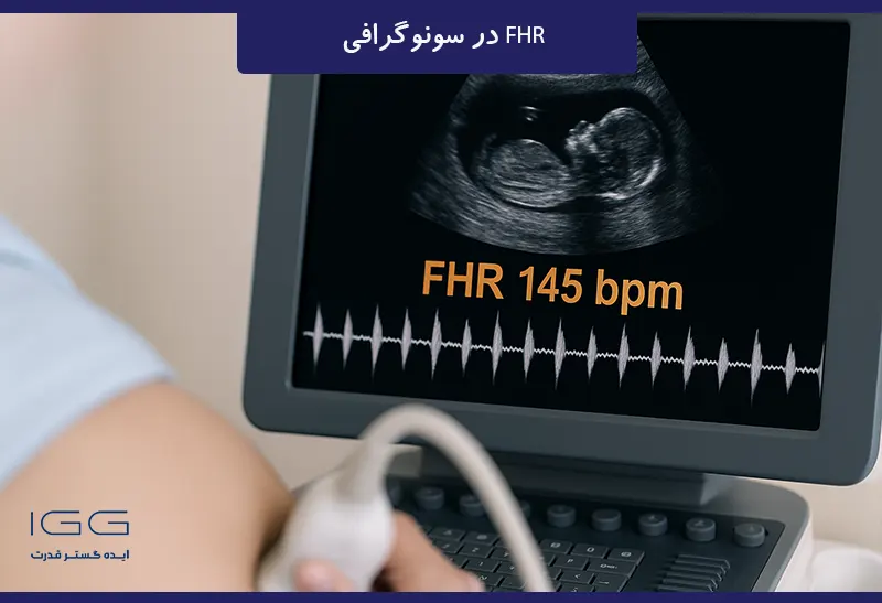 FHR در سونوگرافی چیست؟ اهمیت FHR در سونوگرافی بارداری
